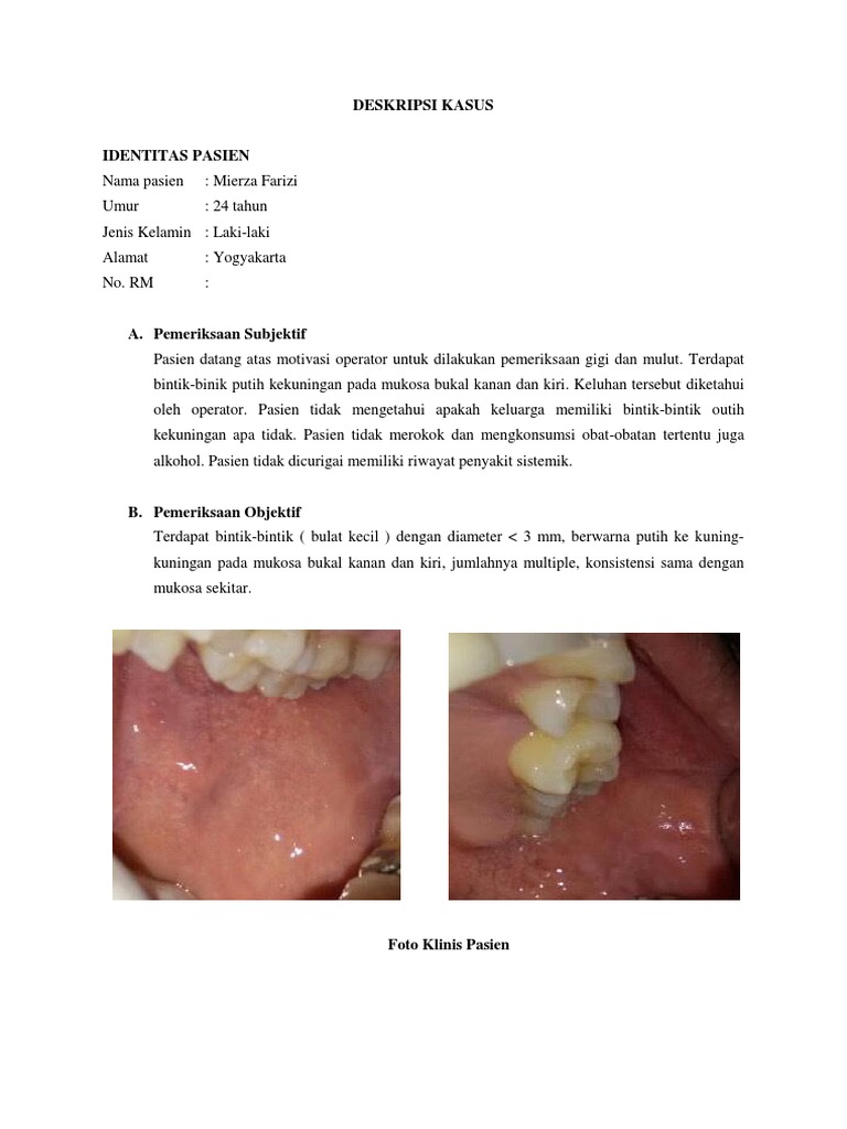 Fordyce Granule | PDF