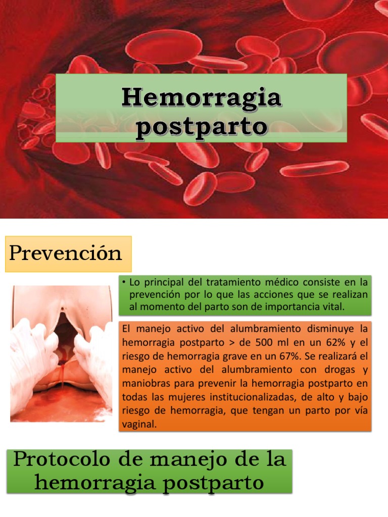 Hemorragia Postparto | PDF | Rtt | La salud de la mujer