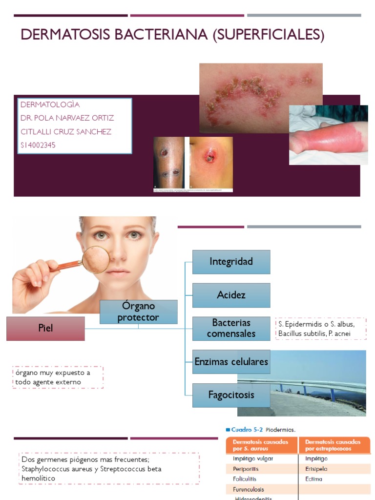 Dermatosis Bacteriana (Superficiales) | PDF | Condiciones cutáneas ...