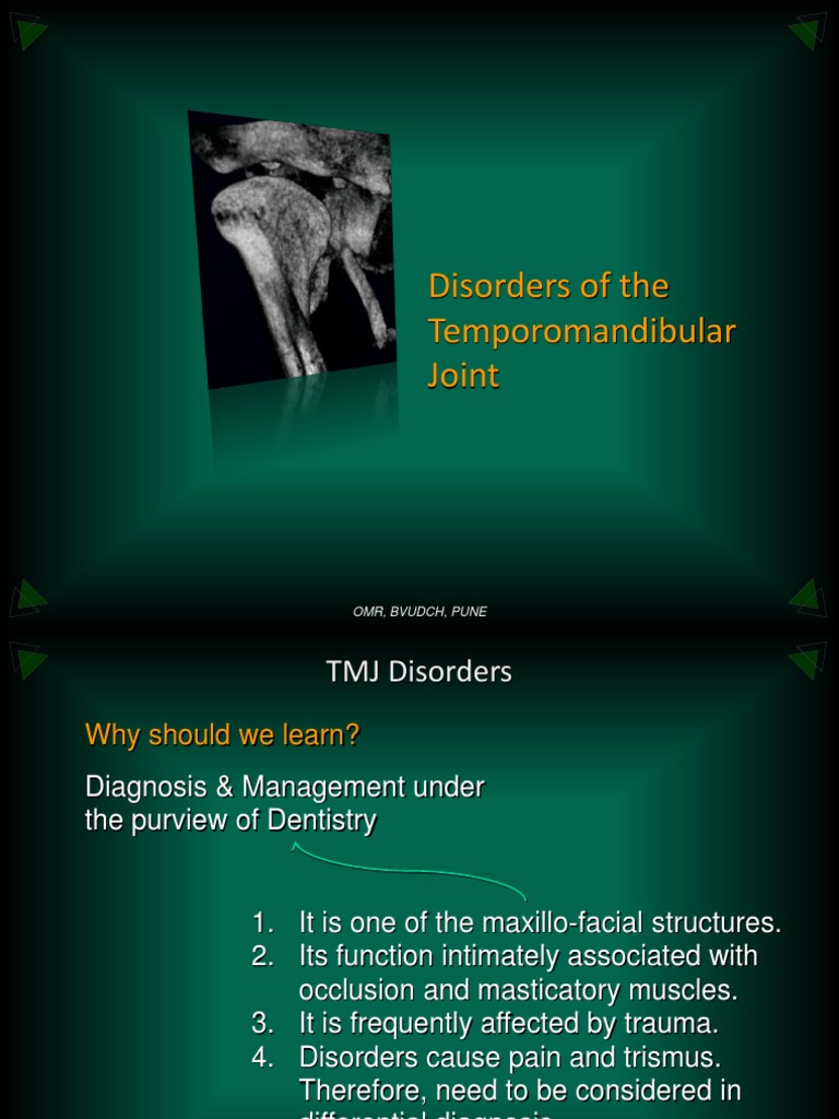 TMJ Disorders | PDF | Clinical Medicine | Medical Specialties