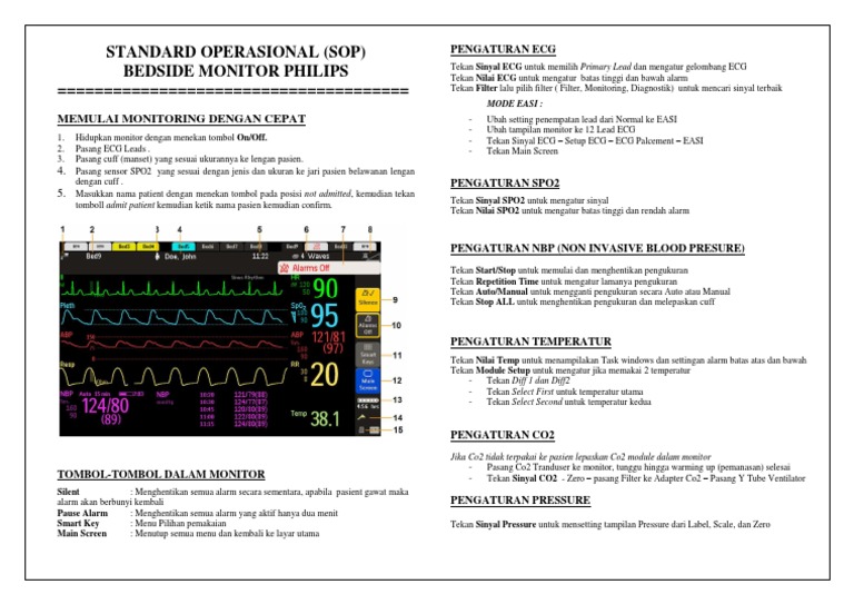 Sop Bedside Monitor Mx400 Philips II | PDF