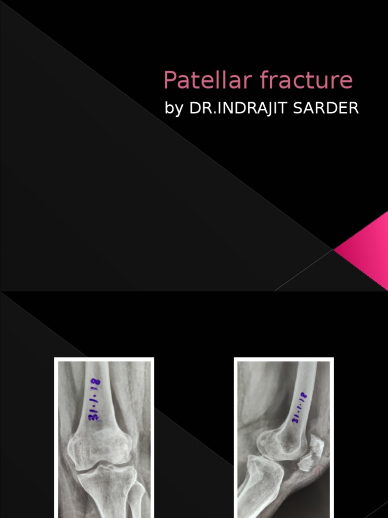 Patella | PDF