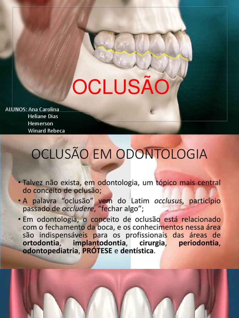 Oclusão: conceito central em odontologia | PDF | Odontologia | Dente