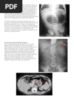 Deterioro Rostrocaudal: Etiología | PDF | Medicina | Sistema nervioso