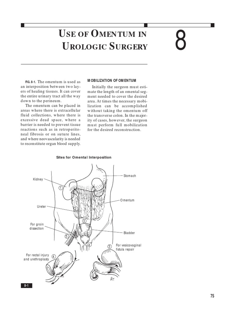 Omentum Patch | PDF | Peritoneum | Urinary Bladder