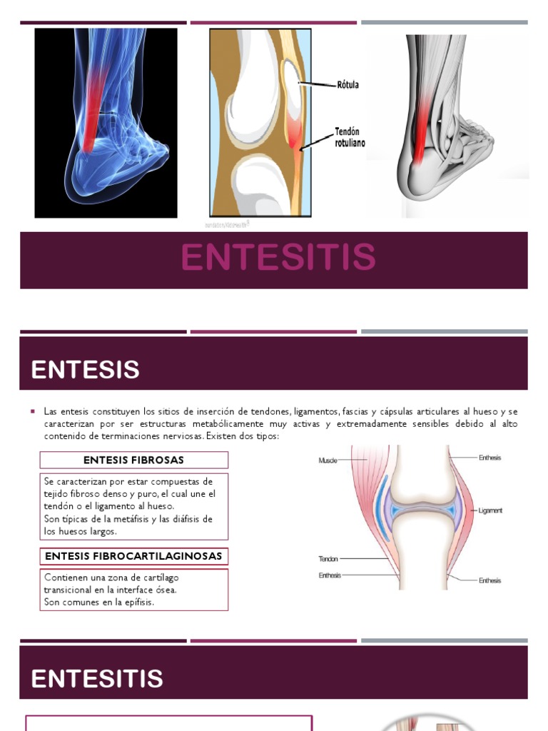 ENTESITIS | PDF | Cartílago | Hueso