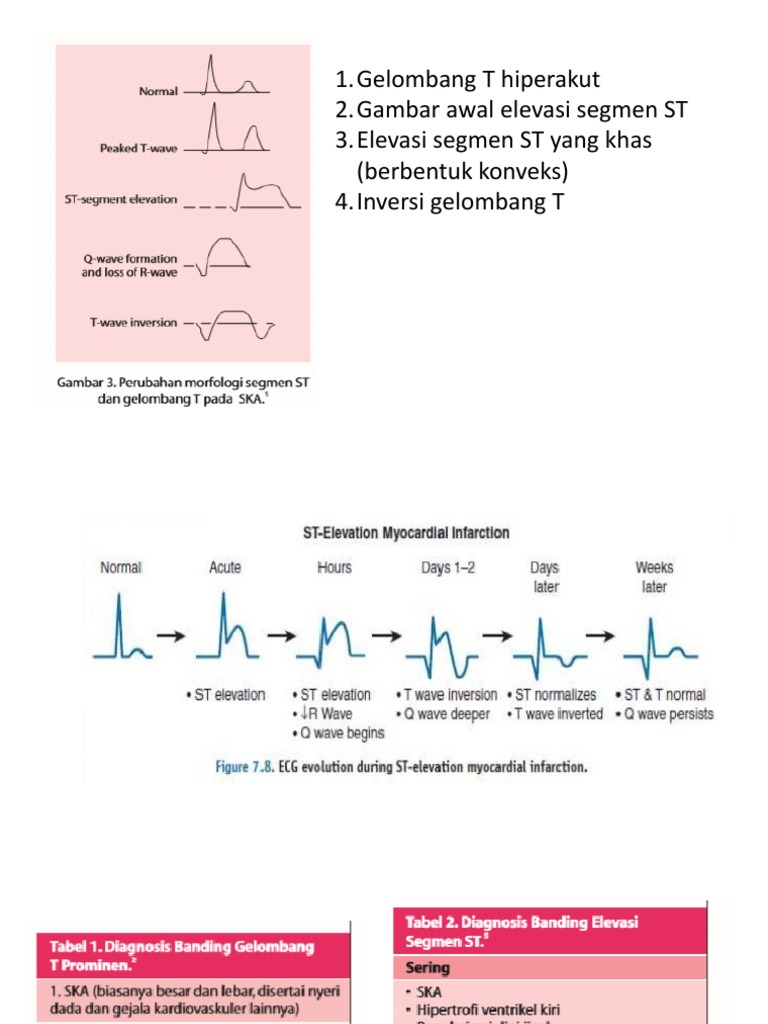 Evolusi ST Elevasi | PDF