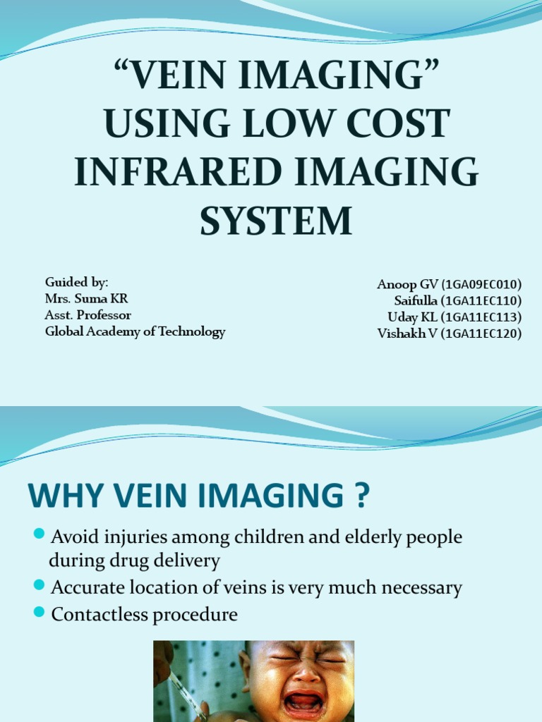 Project PPT 1 | PDF | Infrared | Vein