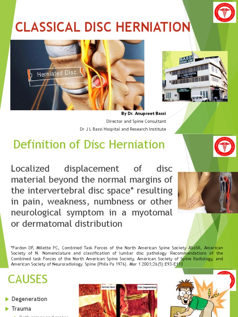 Classical Disc Herniation by DR Anupreet Bassi | PDF | Diseases And ...