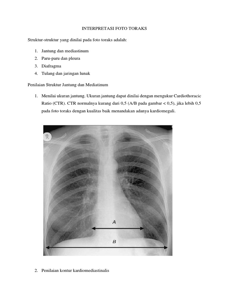 Interpretasi Foto Toraks | PDF
