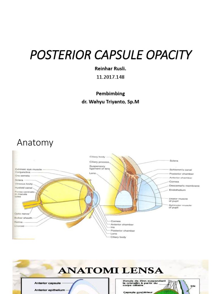 Posterior Capsule Opacity | PDF