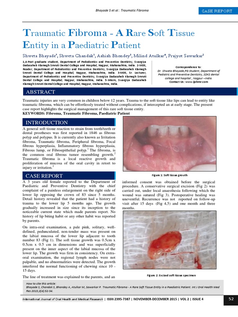 Traumatic Fibroma | PDF | Dentistry | Surgery