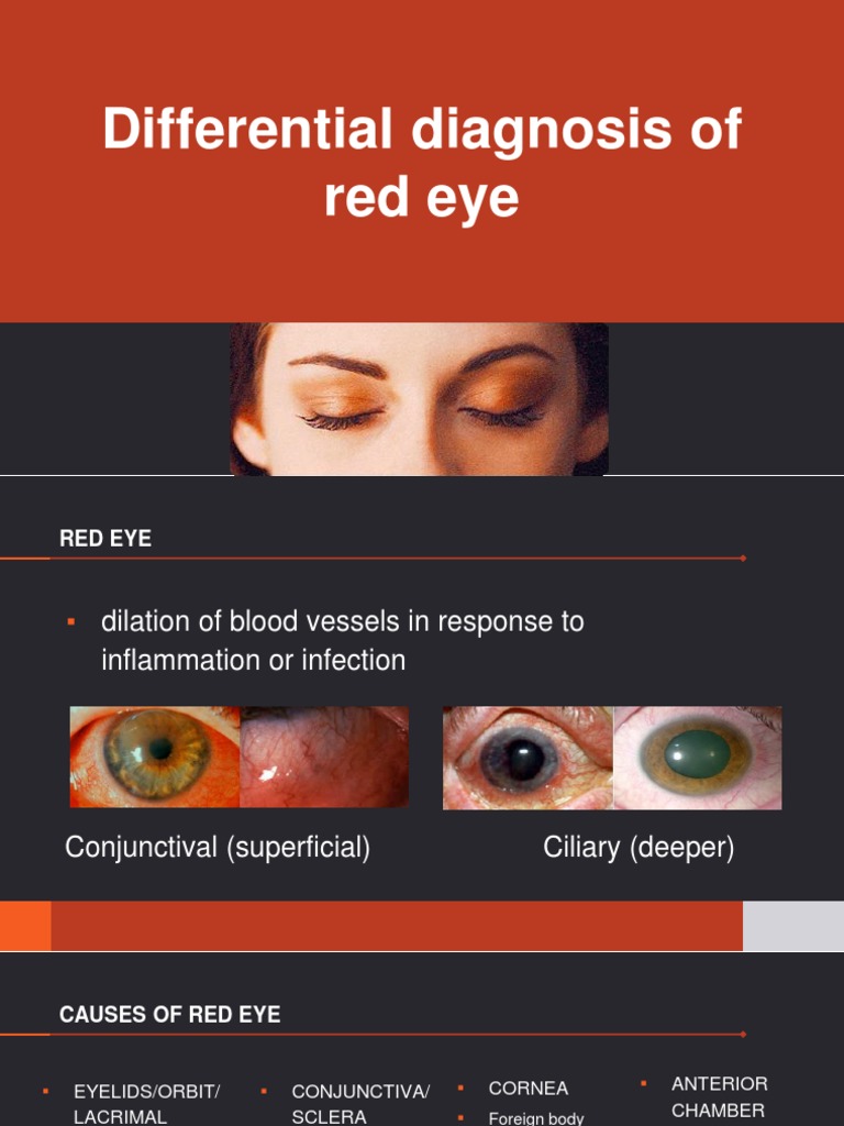 Red Eye | PDF | Glaucoma | Ophthalmology