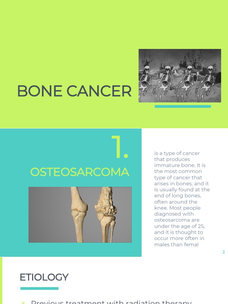 Bone Cancer | PDF | Cancer | Radiation Therapy