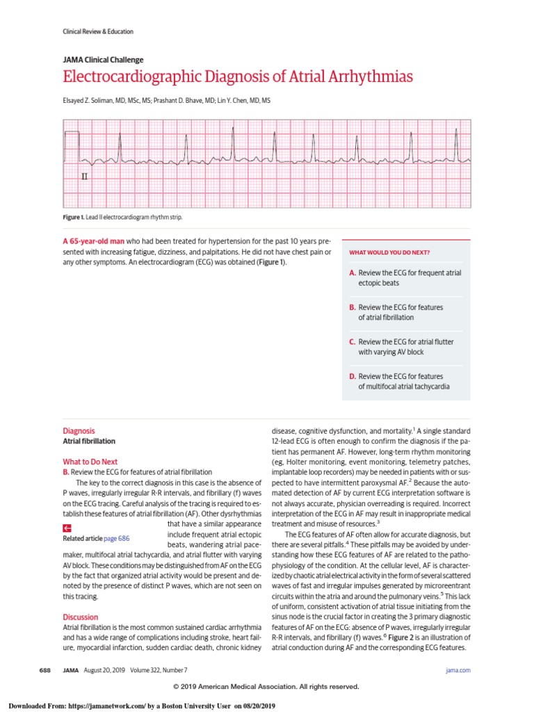 ECG DX de FA | PDF | Electrocardiography | Cardiology
