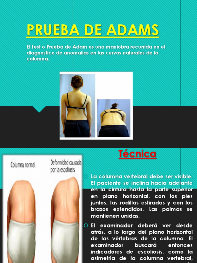 Prueba de Adams | PDF | La columna vertebral | Escoliosis