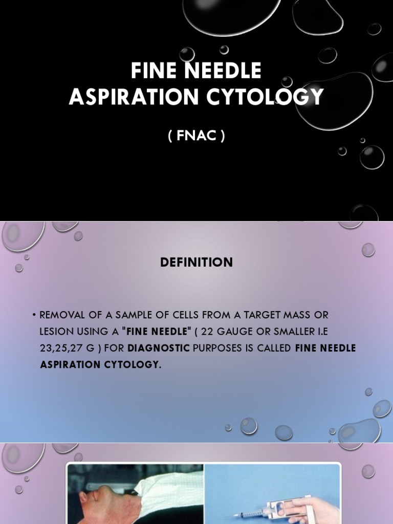 Fine Needle Aspiration Cytology Overview | PDF | Biopsy | Cytopathology