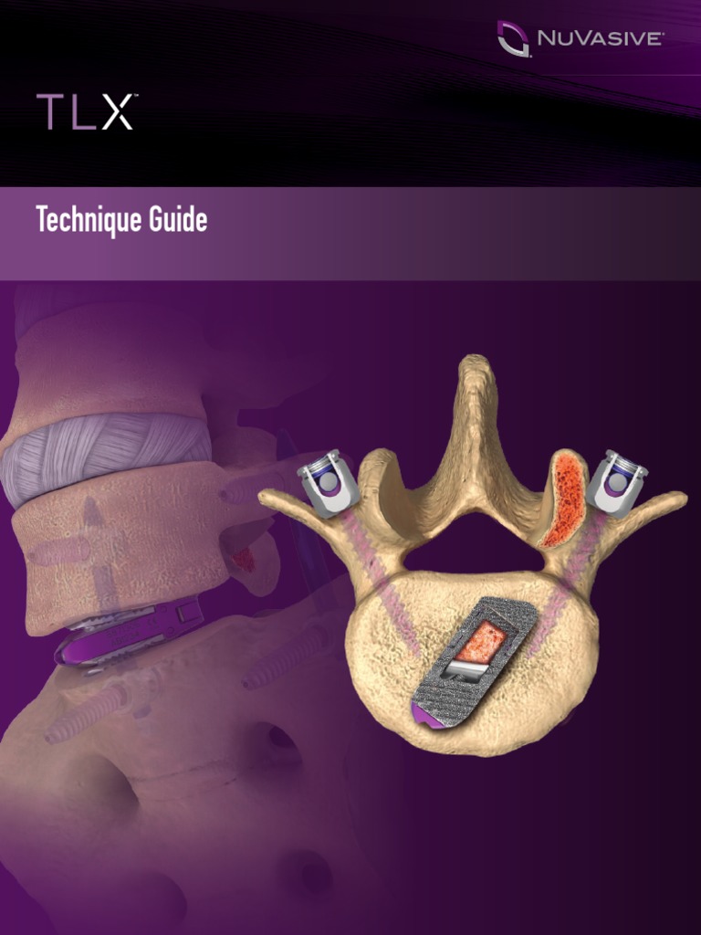 TLX Technique Guide | PDF | Implant (Medicine) | Electromyography