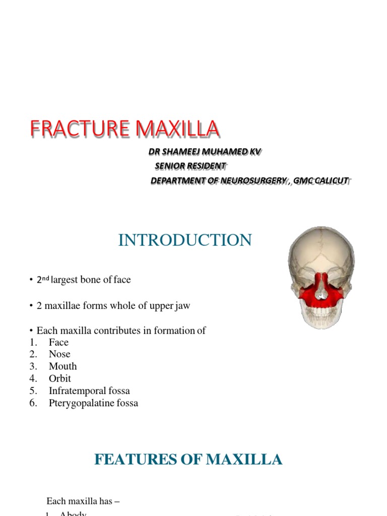 Fracture Maxilla: DR Shameej Muhamed KV Senior Resident Department of ...