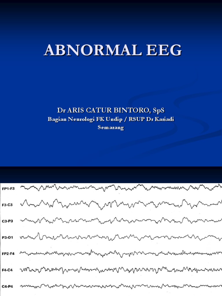 Abnormal Eeg | PDF