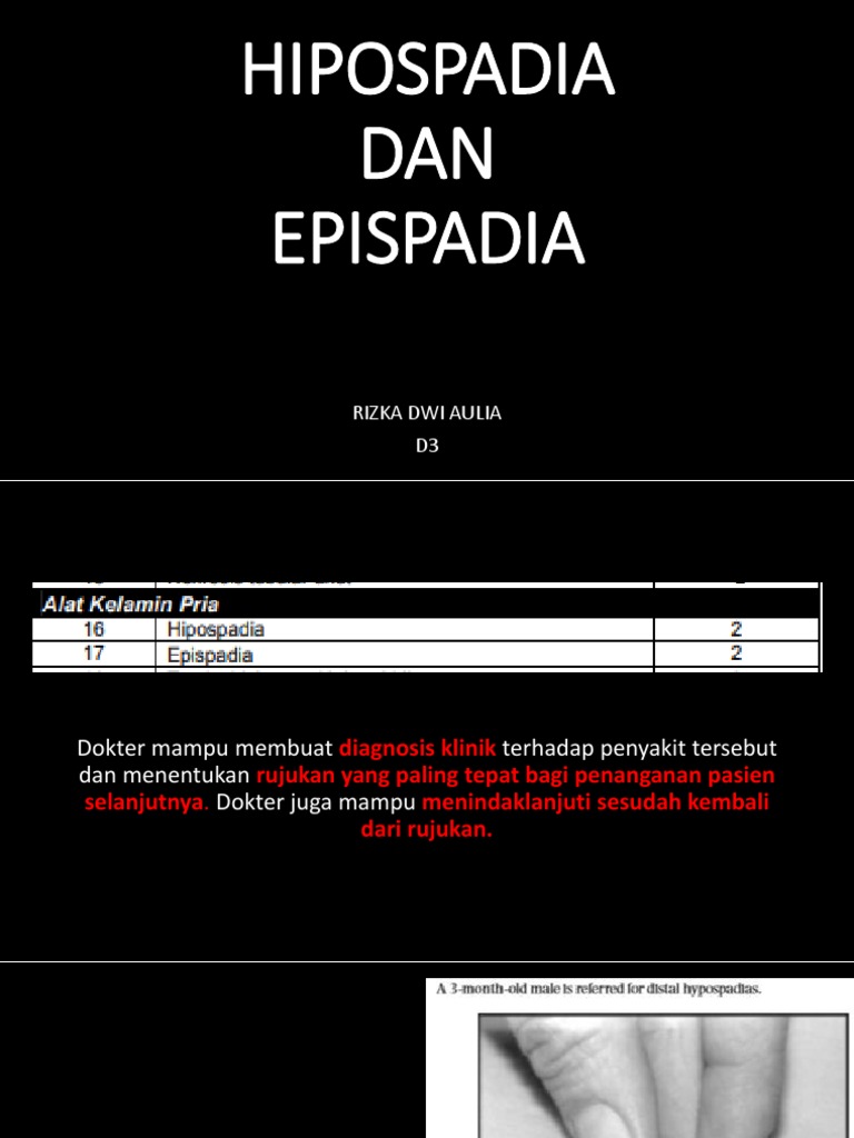Hipospadia Dan Epispadia | PDF | Urinary Incontinence | Clitoris