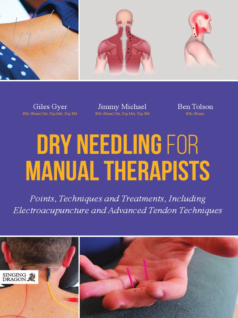 Dry Needling for Manual Therapists Points, Techniques and Treatments ...