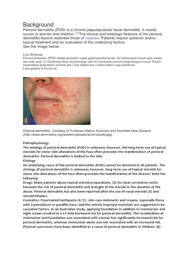 Perioral Dermatitis: Causes & Treatment | PDF | Medical Specialties | Drugs