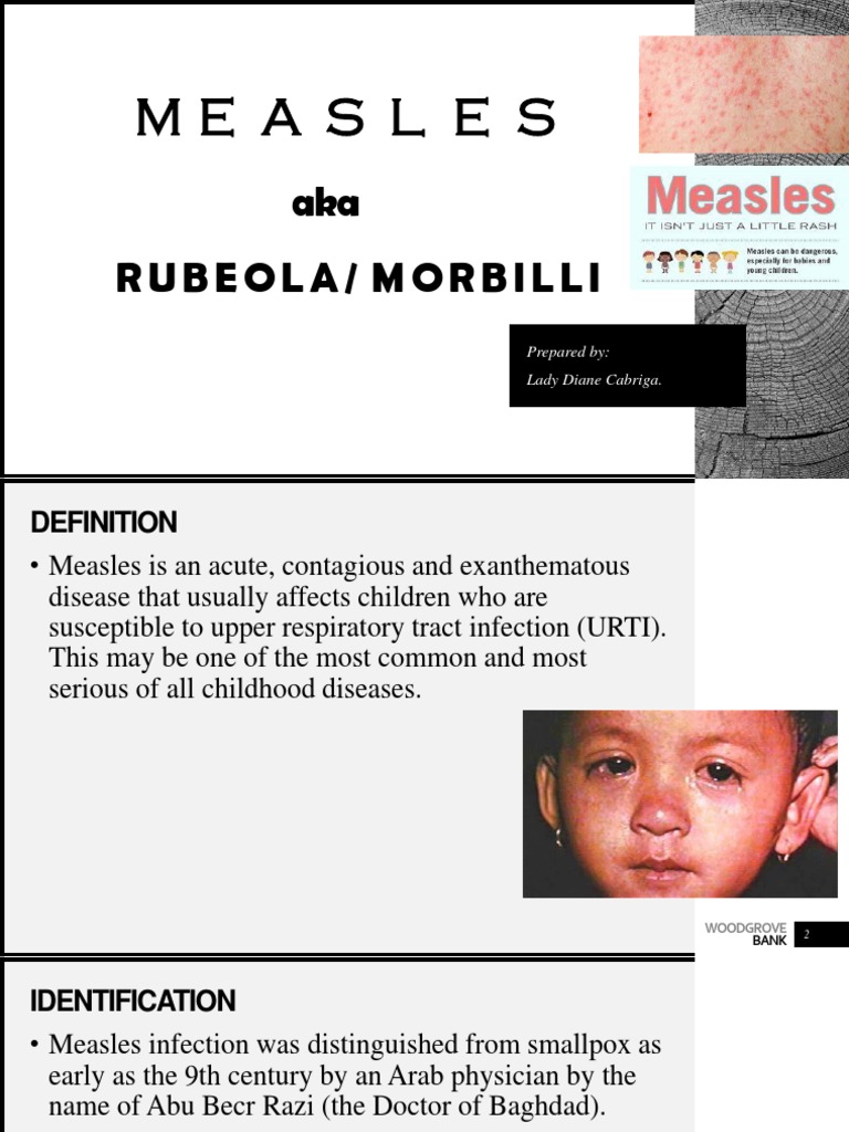 Me A S L E S: Aka Rubeola/ Morbilli | PDF | Measles | Infection