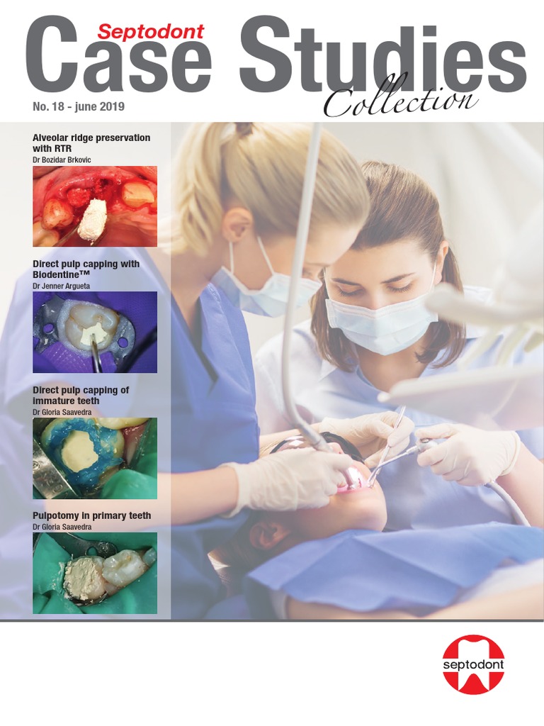 Septodont | PDF | Dental Implant | Human Tooth