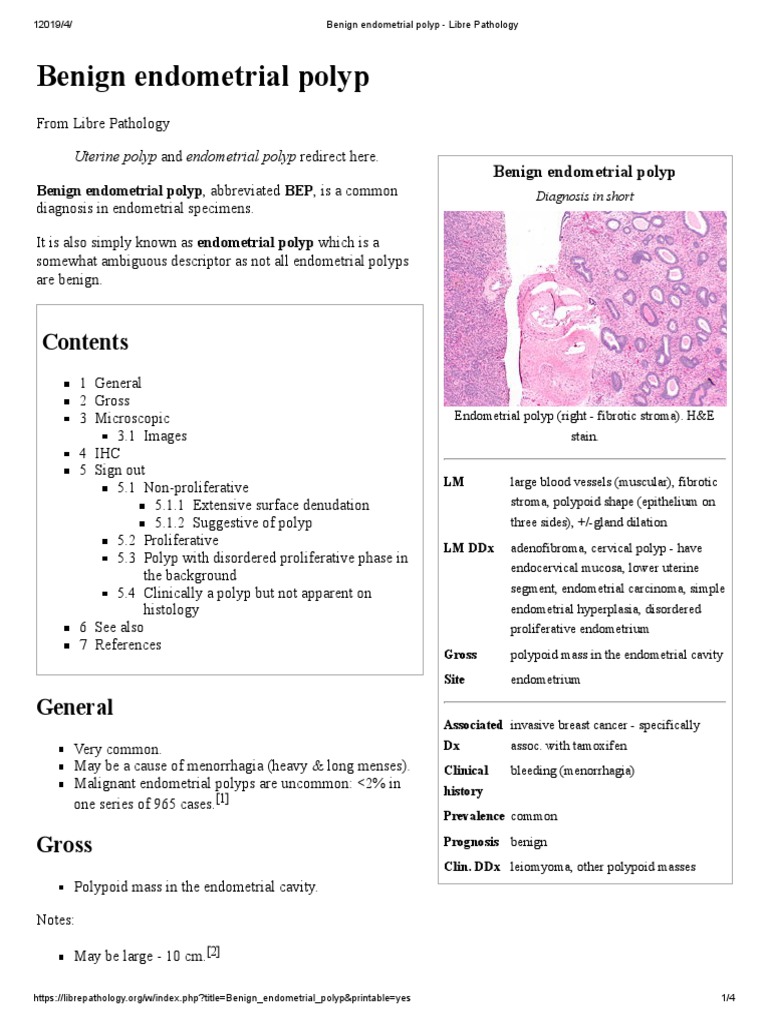 6 Endometrial Polyp - Libre Pathology | PDF | Pathology | Mammal Female ...