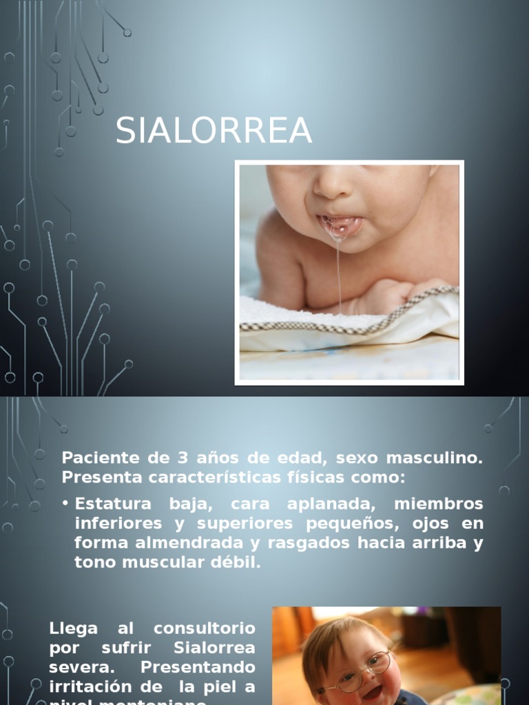 Sialorrea | PDF | Síndrome de Down | Medicina