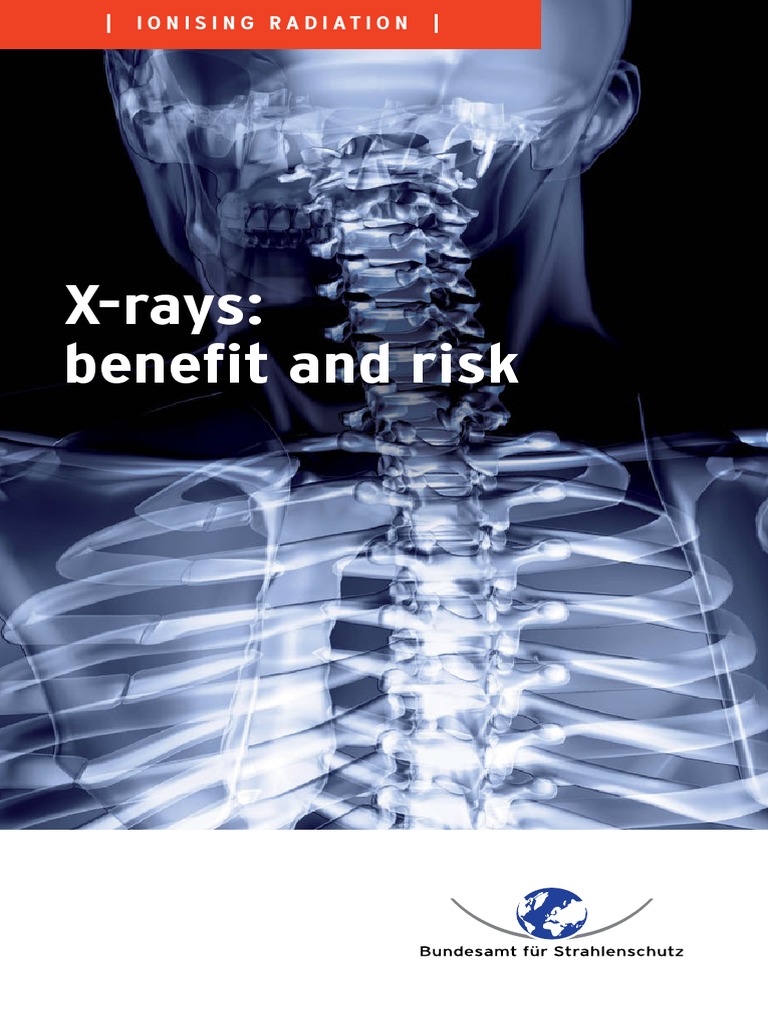 X-Rays: Benefit and Risk | PDF | Ct Scan | X Ray