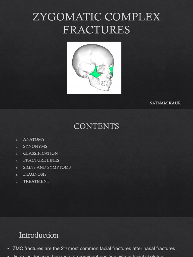 Zygomatic Complex Fractures Overview | PDF | Musculoskeletal System ...
