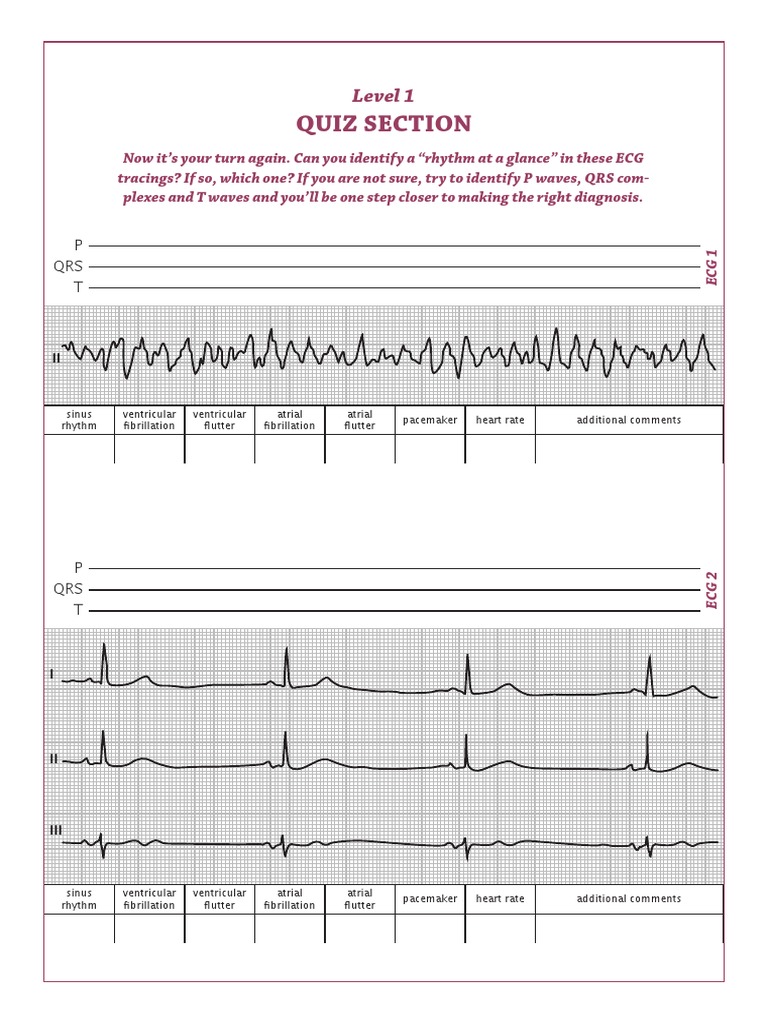 Quiz Section: Level 1 | PDF | Electrocardiography | Artificial Cardiac ...