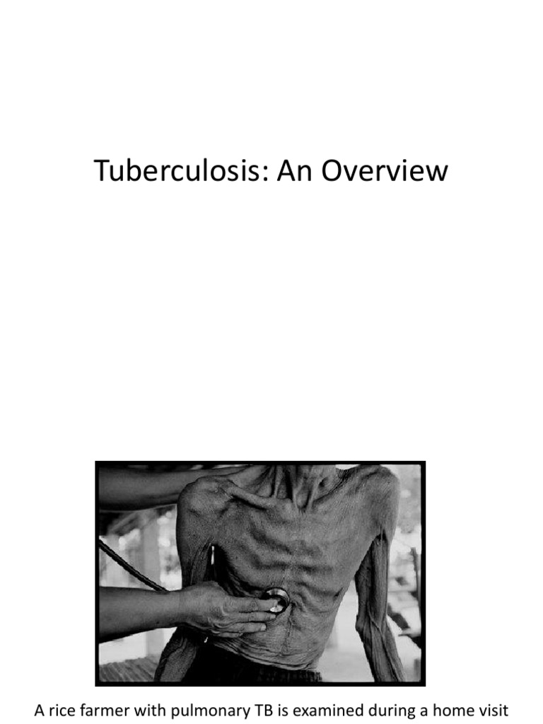 Tuberculosis: An Overview | PDF | Tuberculosis | Infection
