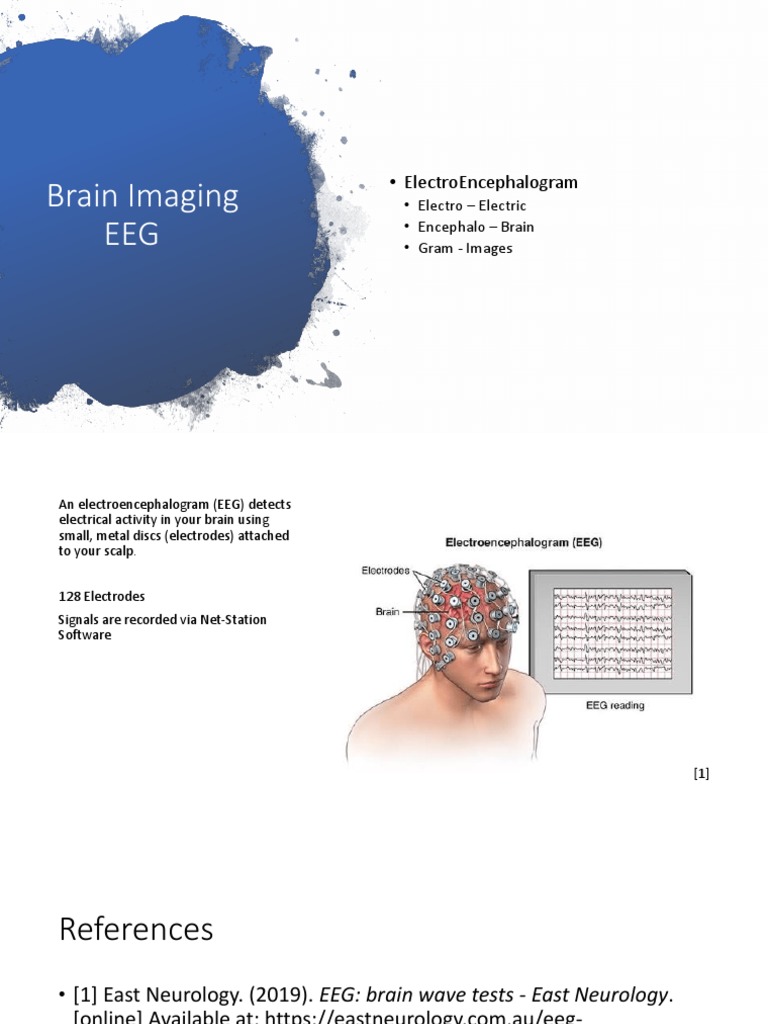 Brain Imaging Eeg: - Electroencephalogram | PDF
