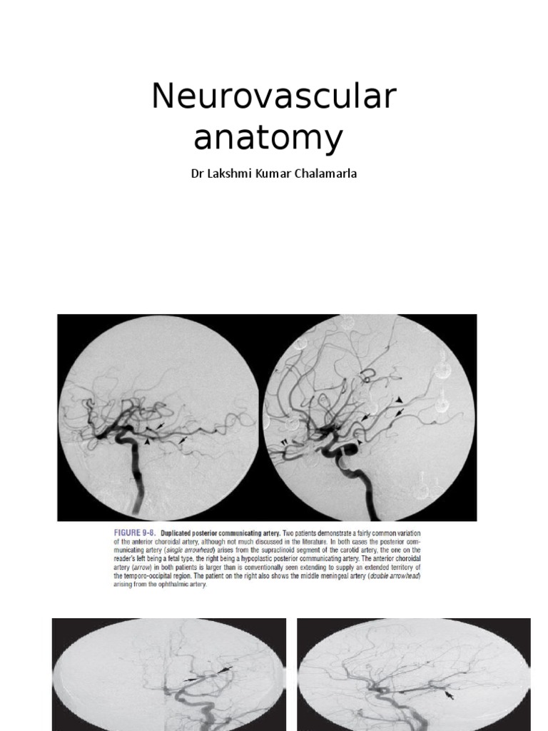 Neurovascular Anatomy Additional Slides | PDF