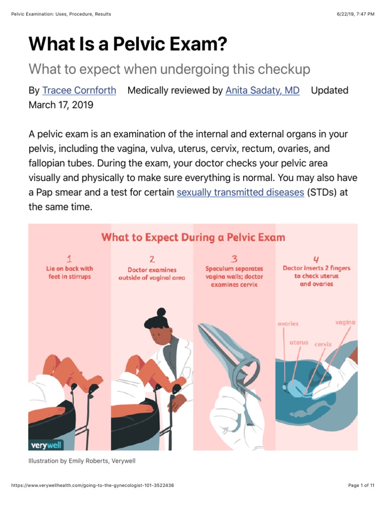 Pelvic Examination: Uses, Procedure, Results | PDF | Vagina | Medical ...