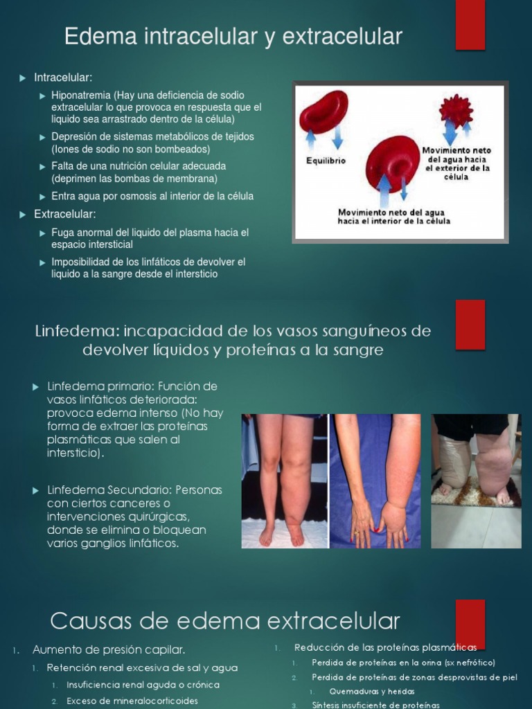 Edema Intracelular y Extracelular | PDF | Edema | Sistema linfático