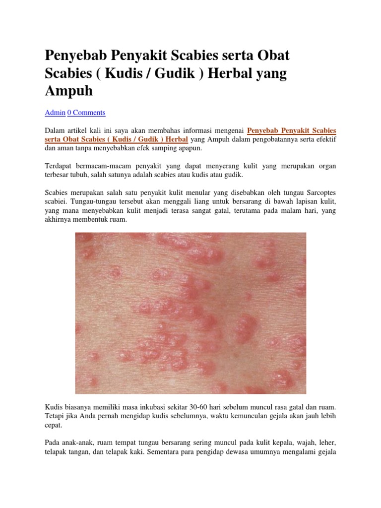 Scabies Atau Kutu Air | PDF