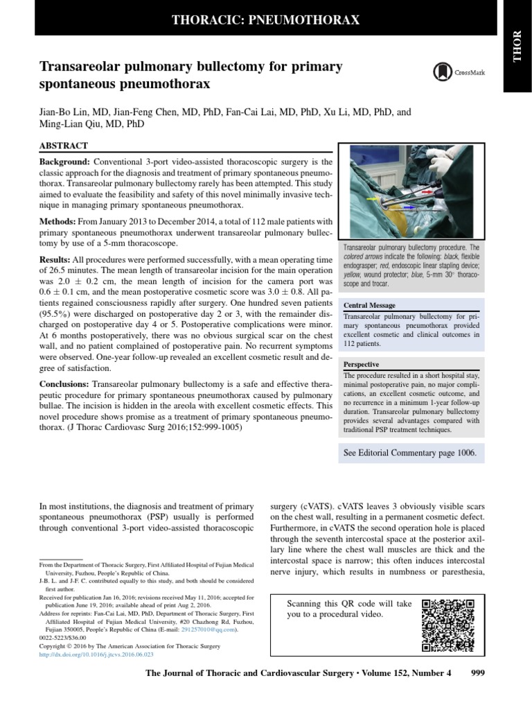 Transareolar Pulmonary Bullectomy For Primary Spontaneous Pneumothorax ...