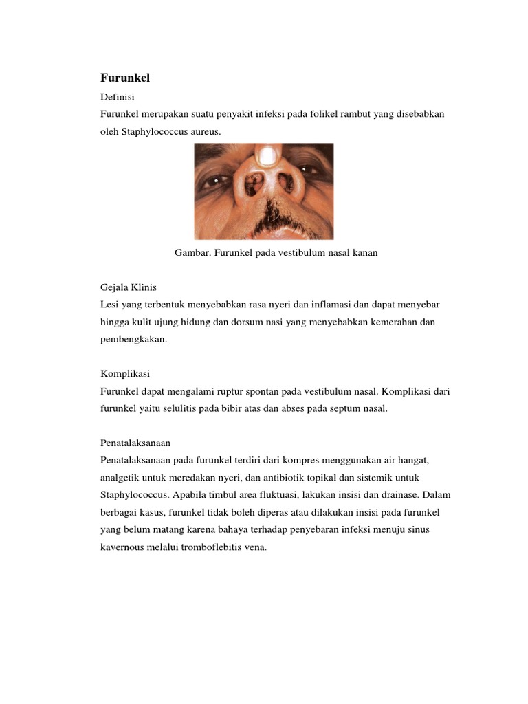 Penatalaksanaan Furunkel Nasal | PDF | Sains & Matematika