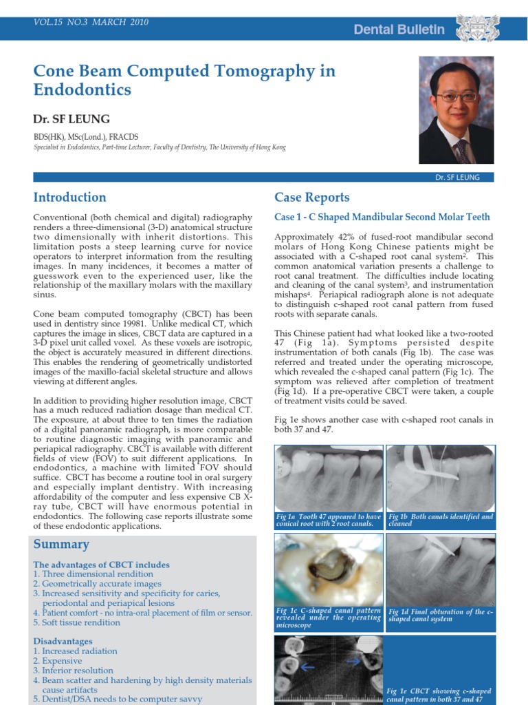 Cone Beam Computed Tomography in Endodontics: Case Reports | PDF ...