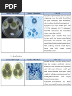 Perbedaan Kapang Dan Khamir (Mould and Yeast) | PDF