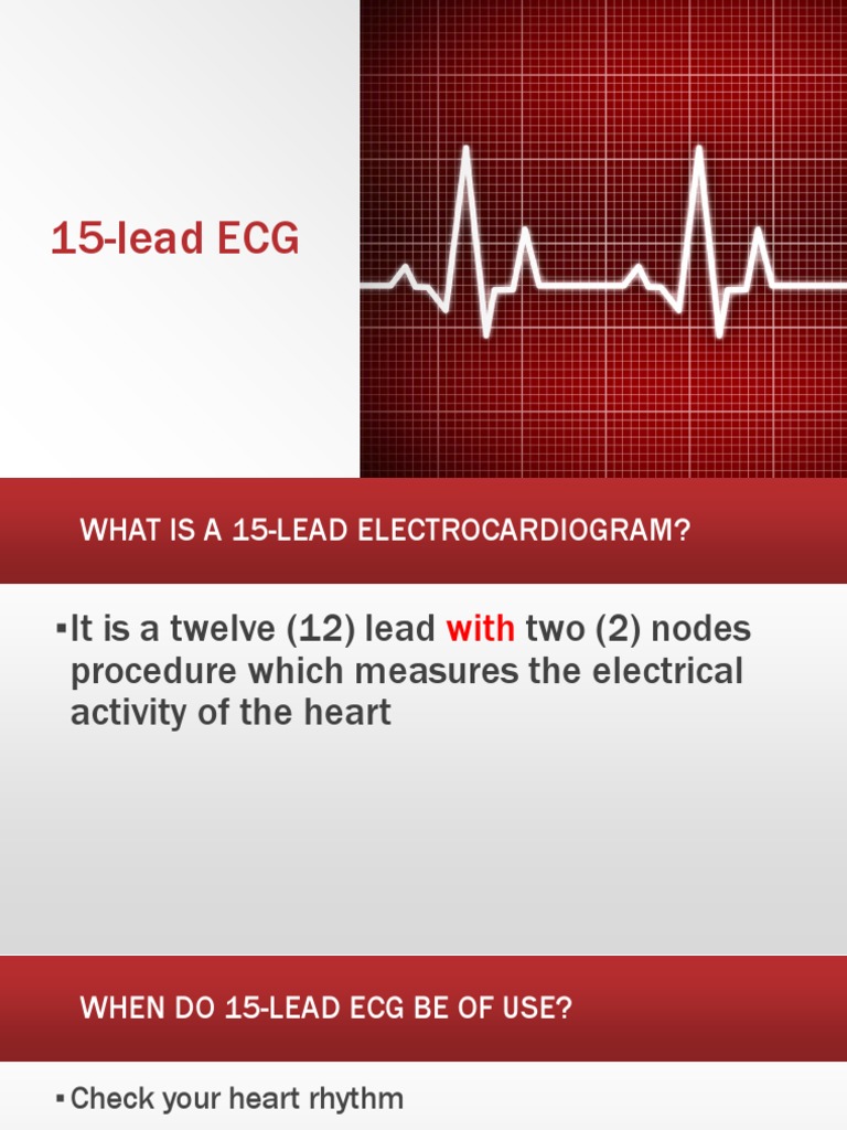 15 Lead ECG | PDF