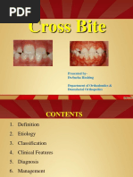 Management of Crossbite | PDF | Dental Anatomy | Human Anatomy