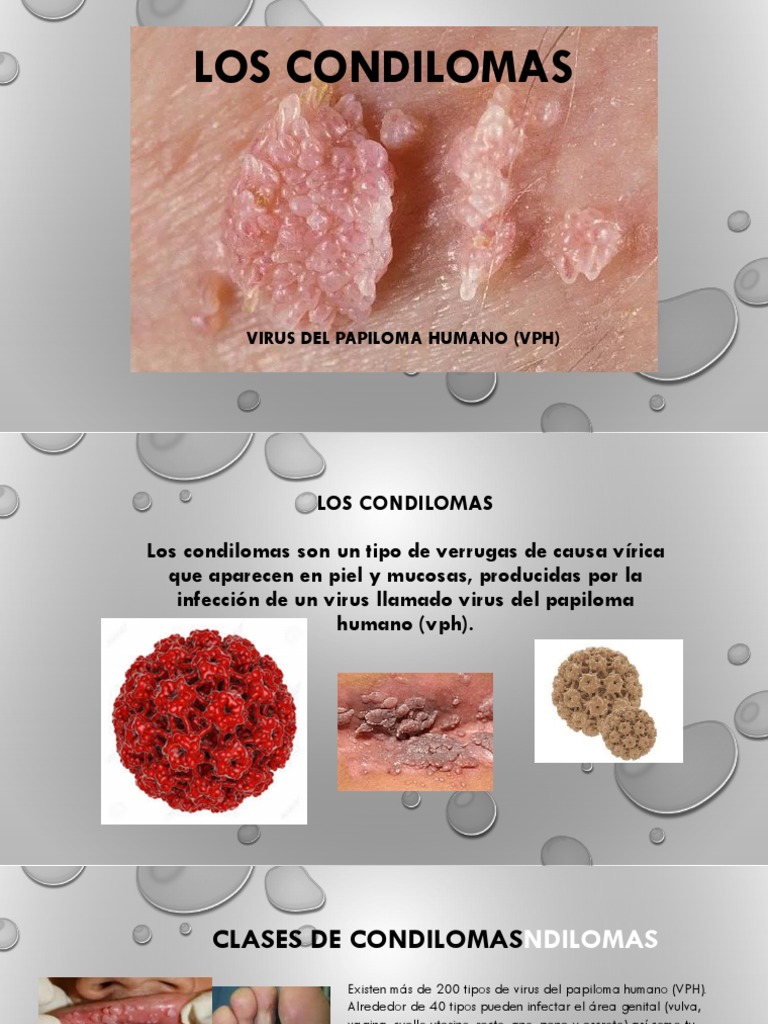 Los Condilomas | PDF | Especialidades Medicas | Medicina