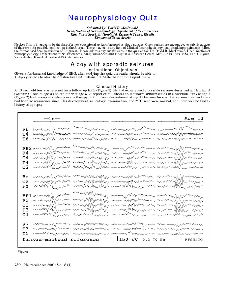 Neurophysiology Quiz Oct 03 | PDF | Epilepsy | Electroencephalography