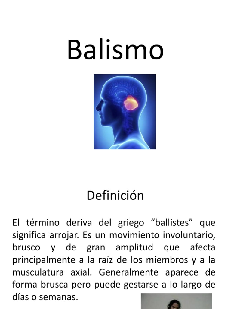 Balismo Expo | PDF | Salud y bienestar