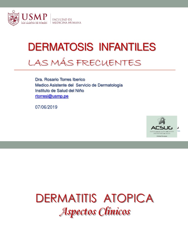 Dermatitis Atopica CLASE PEDIATRIA II ESPECIALIDADES DERMATOLOGIA | PDF ...